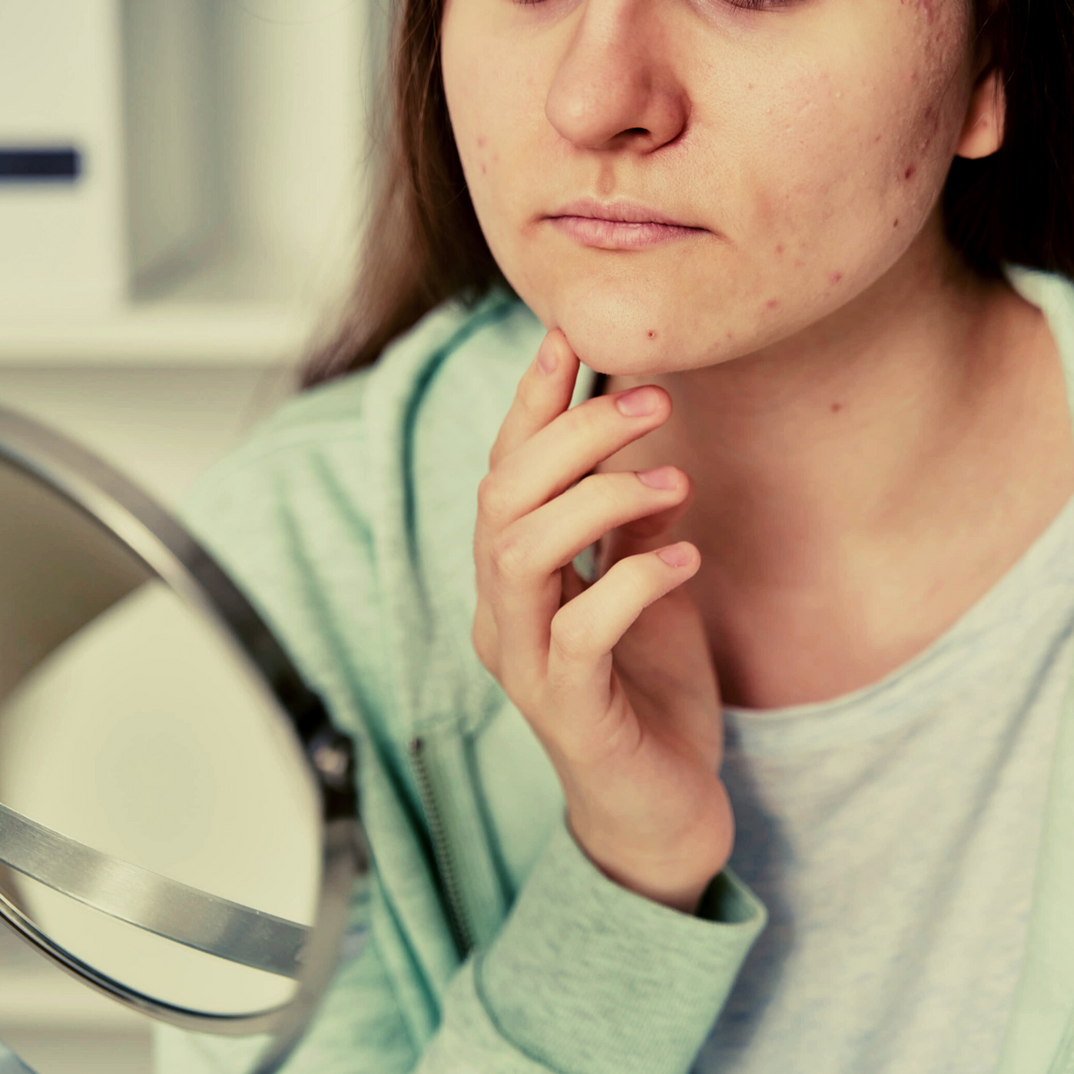 Come regolare il sebo della pelle in modo naturale? - Nidéco